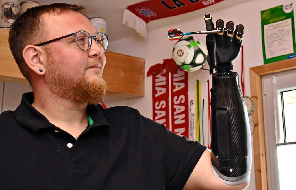 Jahrelang Schmerzen: Entscheidung für Amputation ermöglicht einem ...